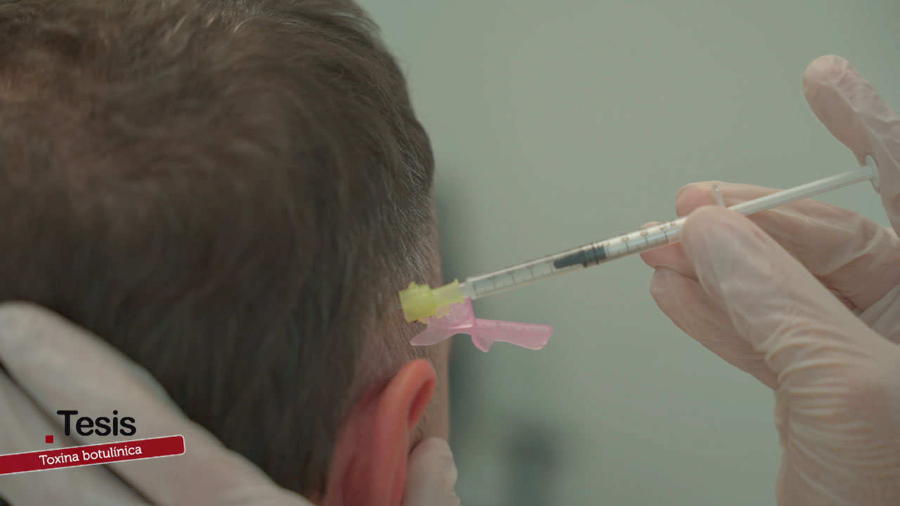 BÓTOX: CUANDO UNA TOXINA SE CONVIERTE EN MEDICINA